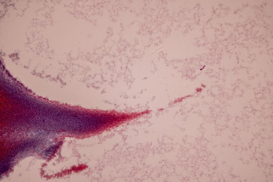 Myocard Bilder – Durchsuchen 9,149 Archivfotos, Vektorgrafiken und ...