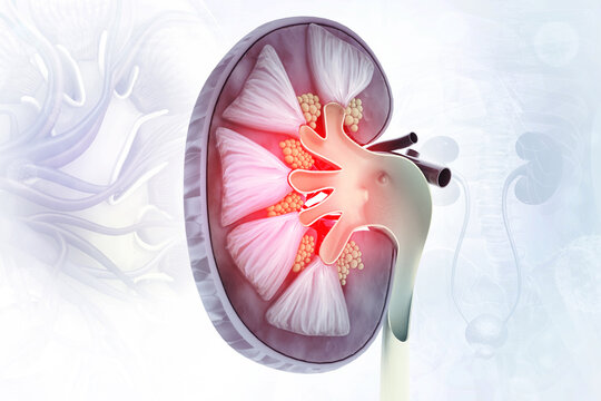 「Nephrolith」の画像 - 3,285 件の Stock 写真、ベクターおよびビデオ | Adobe Stock