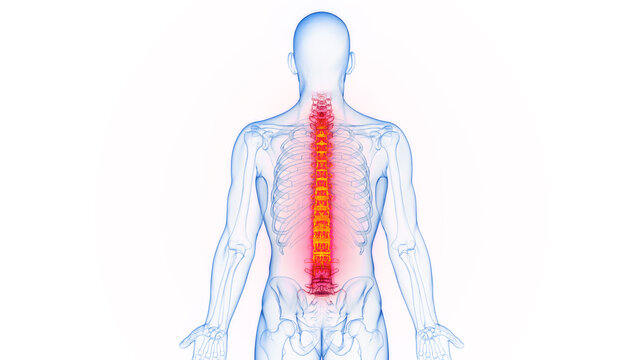 Spondylarthrose Bilder – Durchsuchen 463 Archivfotos, Vektorgrafiken ...