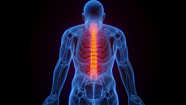 Spondylarthrose Bilder – Durchsuchen 463 Archivfotos, Vektorgrafiken ...