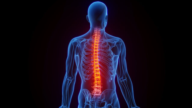 Spondylarthrose Bilder – Durchsuchen 463 Archivfotos, Vektorgrafiken ...