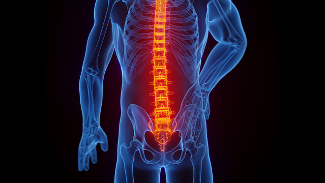 Spondylarthrose Bilder – Durchsuchen 376 Archivfotos, Vektorgrafiken ...