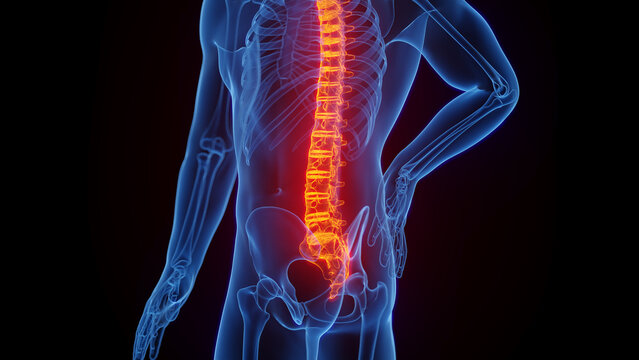 Spondylarthrose Bilder – Durchsuchen 376 Archivfotos, Vektorgrafiken ...