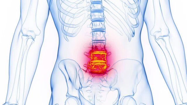 Spondylarthrose Bilder – Durchsuchen 376 Archivfotos, Vektorgrafiken ...