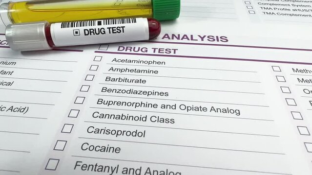 "Drug Test"-Bilder: Stock-Fotos & -Videos. | Adobe Stock
