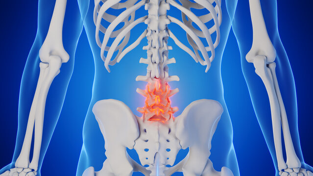 Spondylarthrose Bilder – Durchsuchen 376 Archivfotos, Vektorgrafiken ...