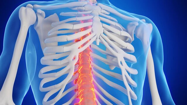 Spondylarthrose Bilder – Durchsuchen 376 Archivfotos, Vektorgrafiken ...