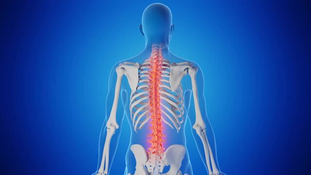 Spondylarthrose Bilder – Durchsuchen 376 Archivfotos, Vektorgrafiken ...