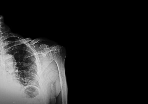 Imagens de X-Rays – Explore Fotografias do Stock, Vetores e Vídeos de ...