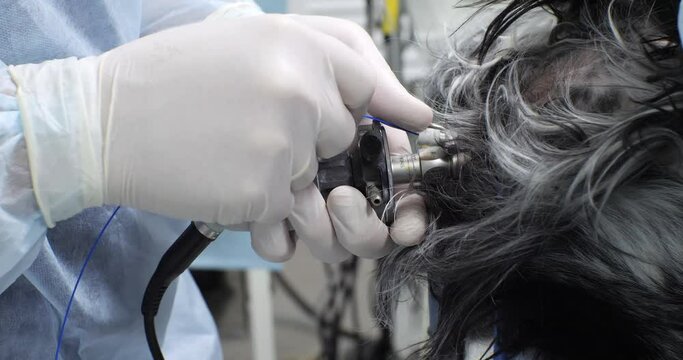 Cauterized Images – Browse 1,594 Stock Photos, Vectors, and Video ...