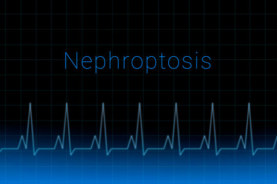 Nephroptosis Bilder – Durchsuchen 194 Archivfotos, Vektorgrafiken und ...