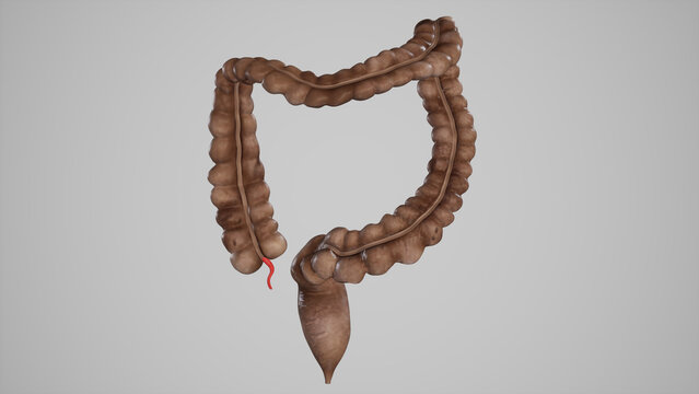 "Sigmoid Flexure" Billeder – Gennemse 499 stockfotos, vektorer og ...