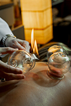 Imágenes de Skinning: descubre bancos de fotos, ilustraciones, vectores ...