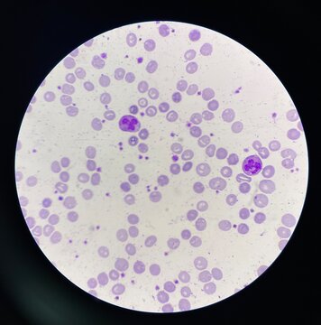 Plasmocyte bilder – Bläddra bland 601 stockfoton, vektorer och videor ...