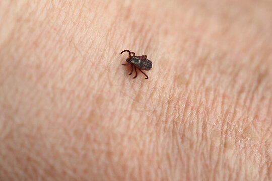 Tbe bilder – Bläddra bland 1,676 stockfoton, vektorer och videor ...