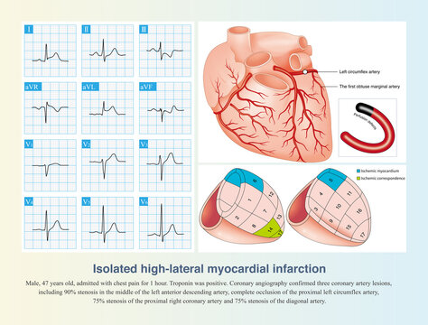 Circumflex Bilder – Durchsuchen 18,887 Archivfotos, Vektorgrafiken und ...
