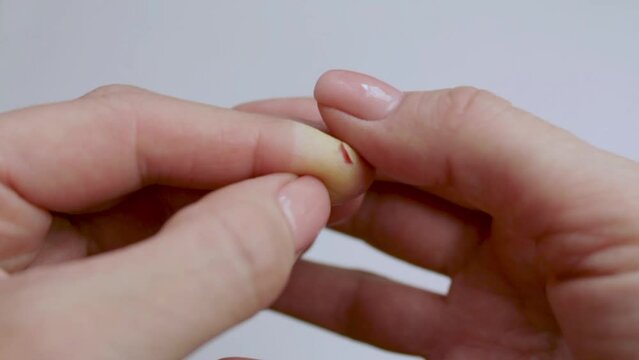 "Knife Wound" Images – Browse 235 Stock Photos, Vectors, and Video ...