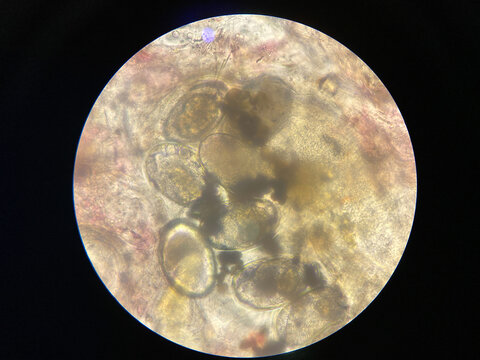 Scabies Eggs Under Microscope