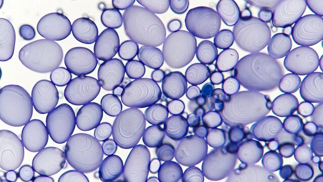 รูปภาพLeucoplast – เลือกดูภาพถ่ายสต็อก เวกเตอร์ และวิดีโอ122 | Adobe Stock