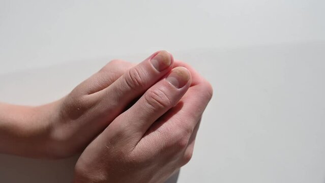 Imagens de Machucado – Explore Fotografias do Stock, Vetores e Vídeos ...