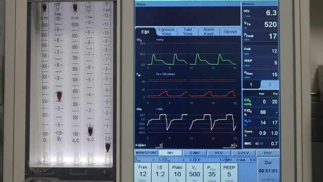 "Anesthesia Machine" Images – Browse 587 Stock Photos, Vectors, and ...