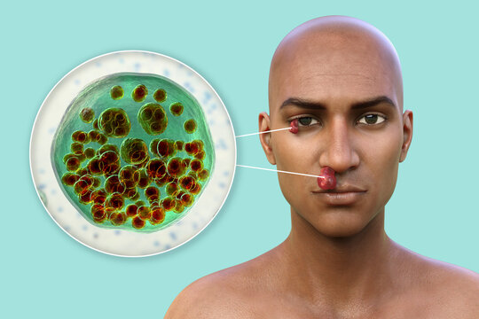 Endemie Bilder – Durchsuchen 120,643 Archivfotos, Vektorgrafiken und ...