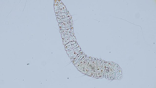 Annelida bilder – Bläddra bland 3,609 stockfoton, vektorer och videor ...
