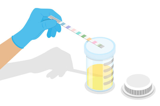 รูปภาพProteinuria – เลือกดูภาพถ่ายสต็อก เวกเตอร์ และวิดีโอ213 | Adobe Stock
