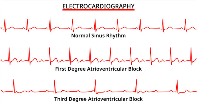 "Third Degree" Images – Browse 117 Stock Photos, Vectors, and Video ...