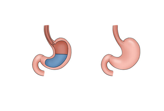 "Stomach Lining" Images – Browse 269 Stock Photos, Vectors, and Video ...