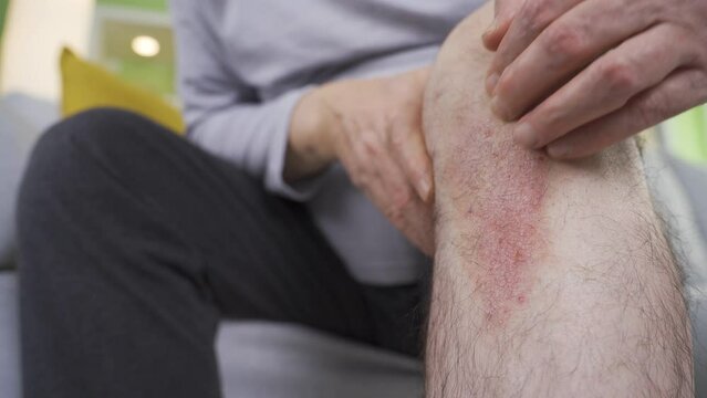 Fungal Bacteria Images – Browse 12,192 Stock Photos, Vectors, and Video ...