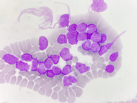 รูปภาพMyeloblast – เลือกดูภาพถ่ายสต็อก เวกเตอร์ และวิดีโอ630 | Adobe Stock