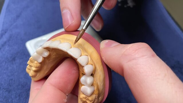 รูปภาพPeriodontist – เลือกดูภาพถ่ายสต็อก เวกเตอร์ และวิดีโอ13,831 ...