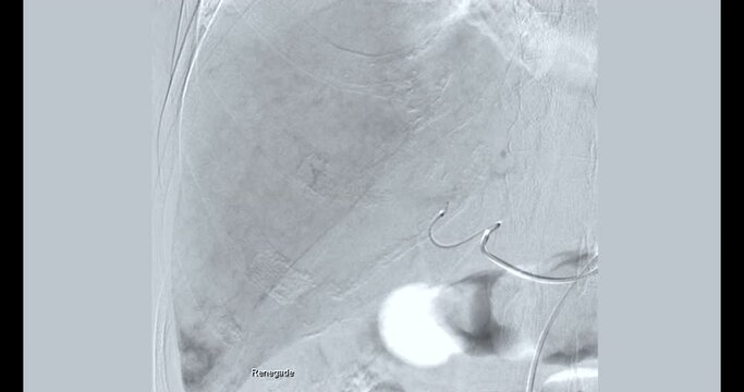 Tace Images – Browse 106 Stock Photos, Vectors, and Video | Adobe Stock