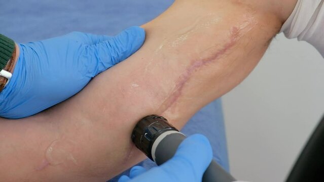 Scars Arms Images – Browse 5,695 Stock Photos, Vectors, and Video ...