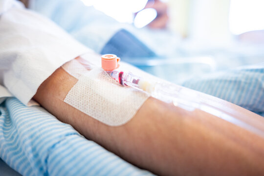 Venflon bilder – Bläddra bland 590 stockfoton, vektorer och videor ...