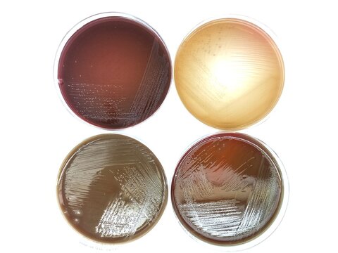 Proteus Vulgaris Macconkey Agar