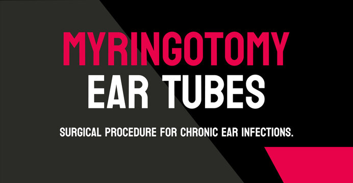 「Myringotomy」の写真素材 | 40件の無料イラスト画像 | Adobe Stock