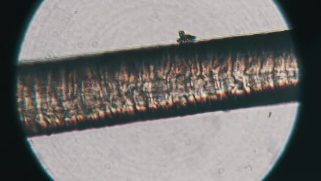 Hair Under Microscope Images – Browse 1,087 Stock Photos, Vectors, and ...