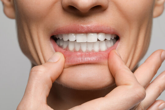 Zahnfleischtaschen Bilder – Durchsuchen 206,366 Archivfotos ...