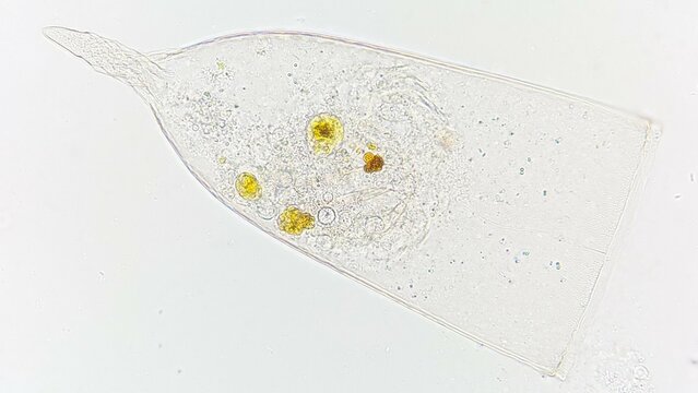 Marine Ciliates