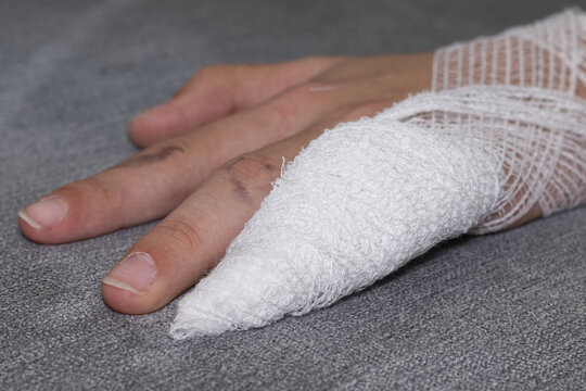 Broken Ring Finger Cast