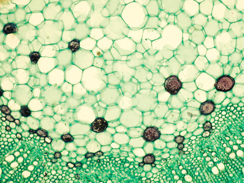 Sclerenchyma Tissue Under Microscope