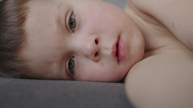 「小児バラ疹」の写真素材 | 1,353件の無料イラスト画像 | Adobe Stock