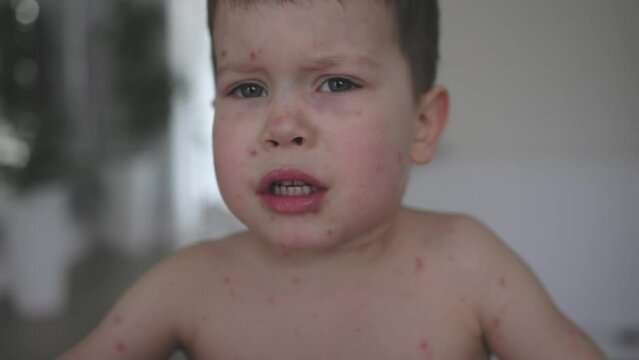 รูปภาพFluid-Filled – เลือกดูภาพถ่ายสต็อก เวกเตอร์ และวิดีโอ133 | Adobe ...