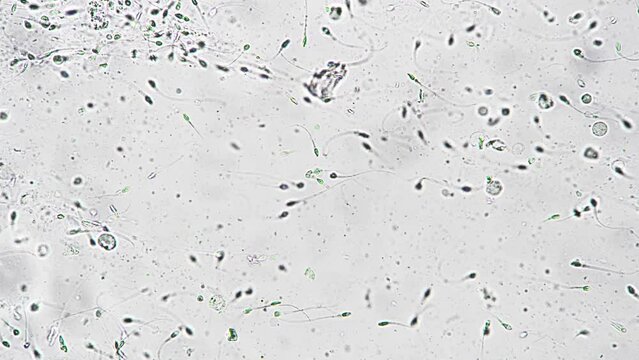 Spermogram bilder – Bläddra bland 306 stockfoton, vektorer och videor ...
