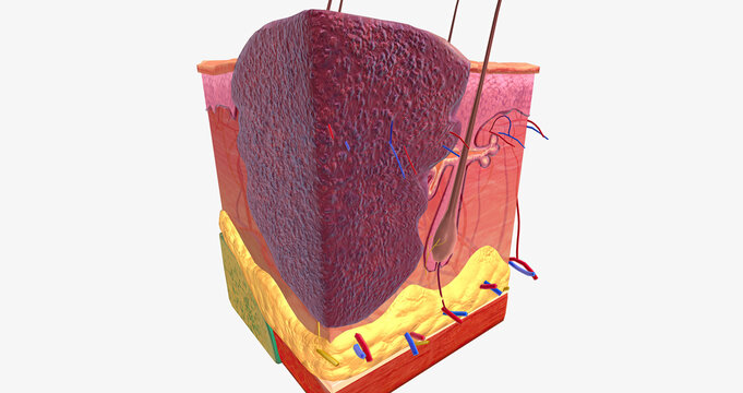 Basaliom-Bilder: Stock-Fotos & -Videos. | Adobe Stock