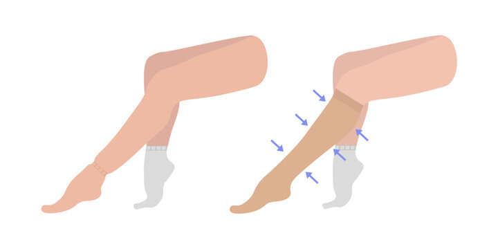 Compression Medical Images – Browse 13,791 Stock Photos, Vectors, and ...