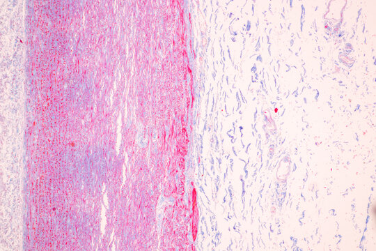 Vascular Background Images – Browse 33,184 Stock Photos, Vectors, and ...