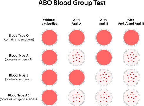 Agglutination 이미지 – 찾아보기 513 스톡 사진, 벡터 및 비디오 | Adobe Stock